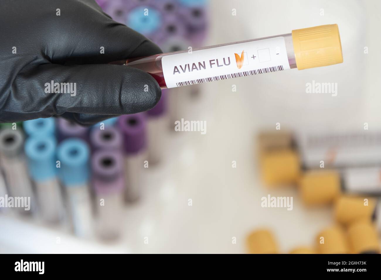 Bird blood sample hi-res stock photography and images - Alamy