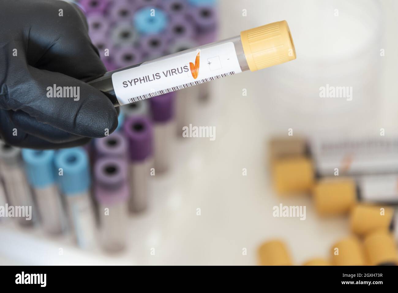 Syphilis test hi-res stock photography and images - Alamy