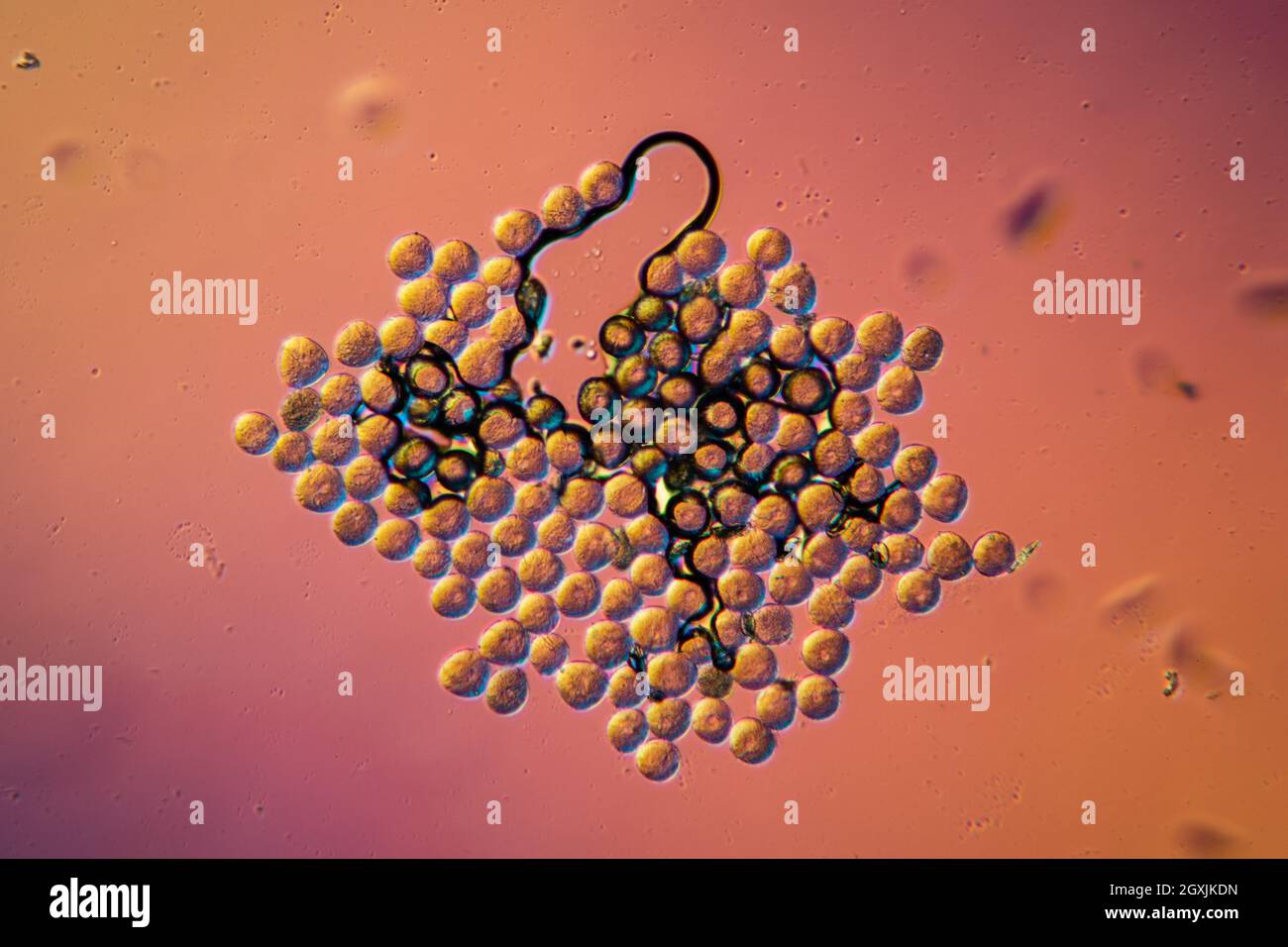 Apple pollen from a blossom in spring under the microscope Stock Photo ...