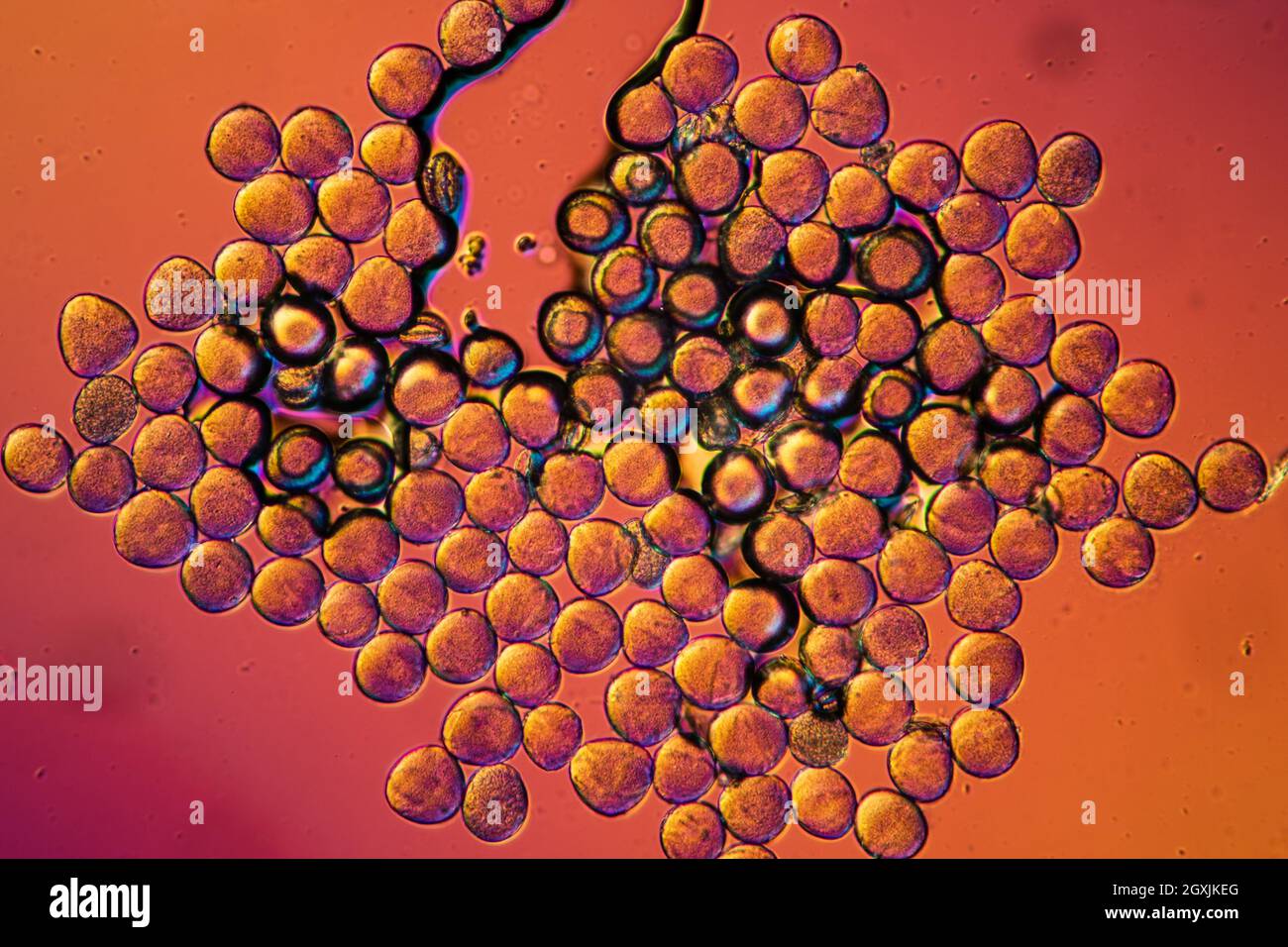 Apple pollen from a blossom in spring under the microscope Stock Photo ...