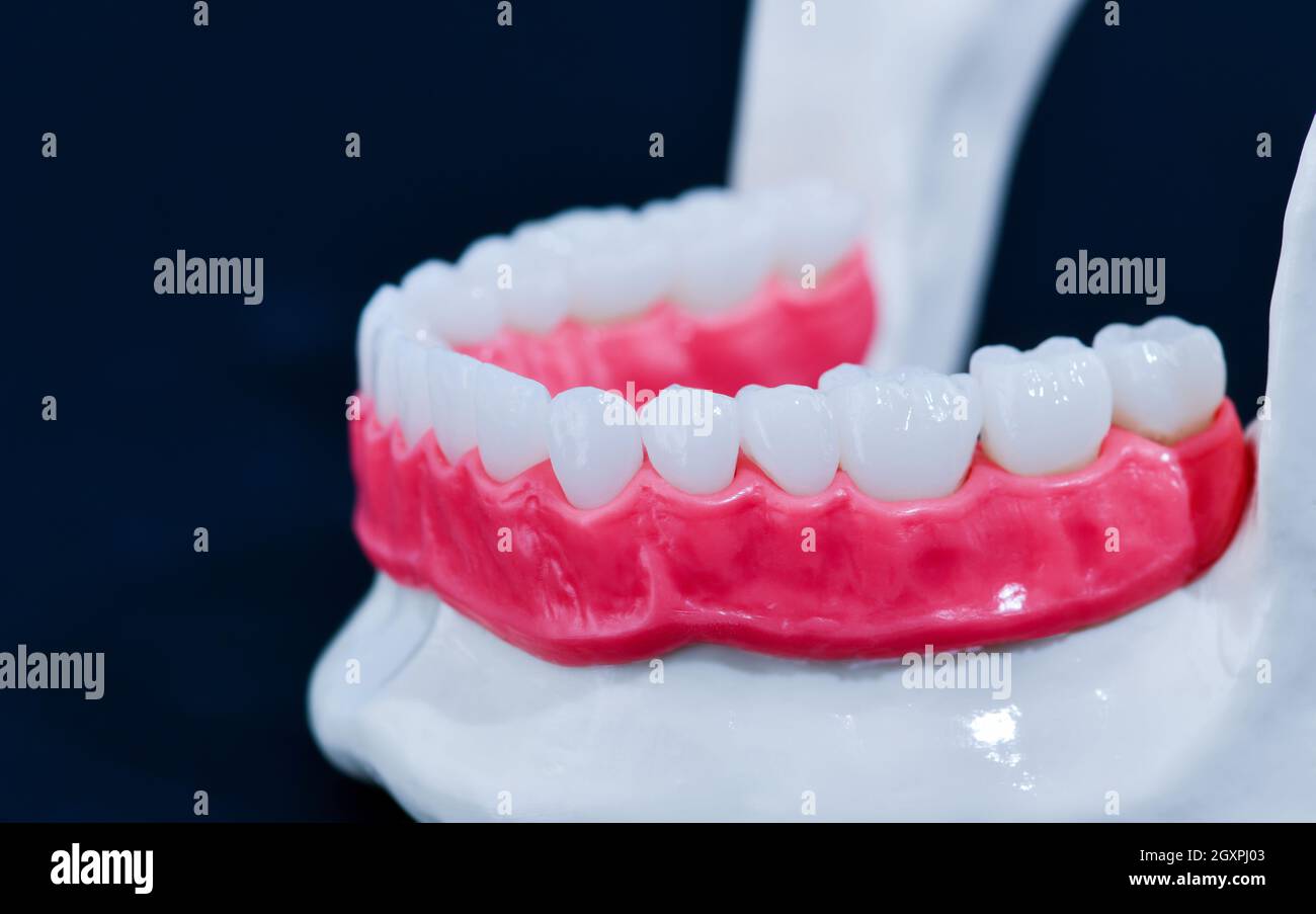 Lower human jaw with teeth and gums anatomy model medical illustration ...