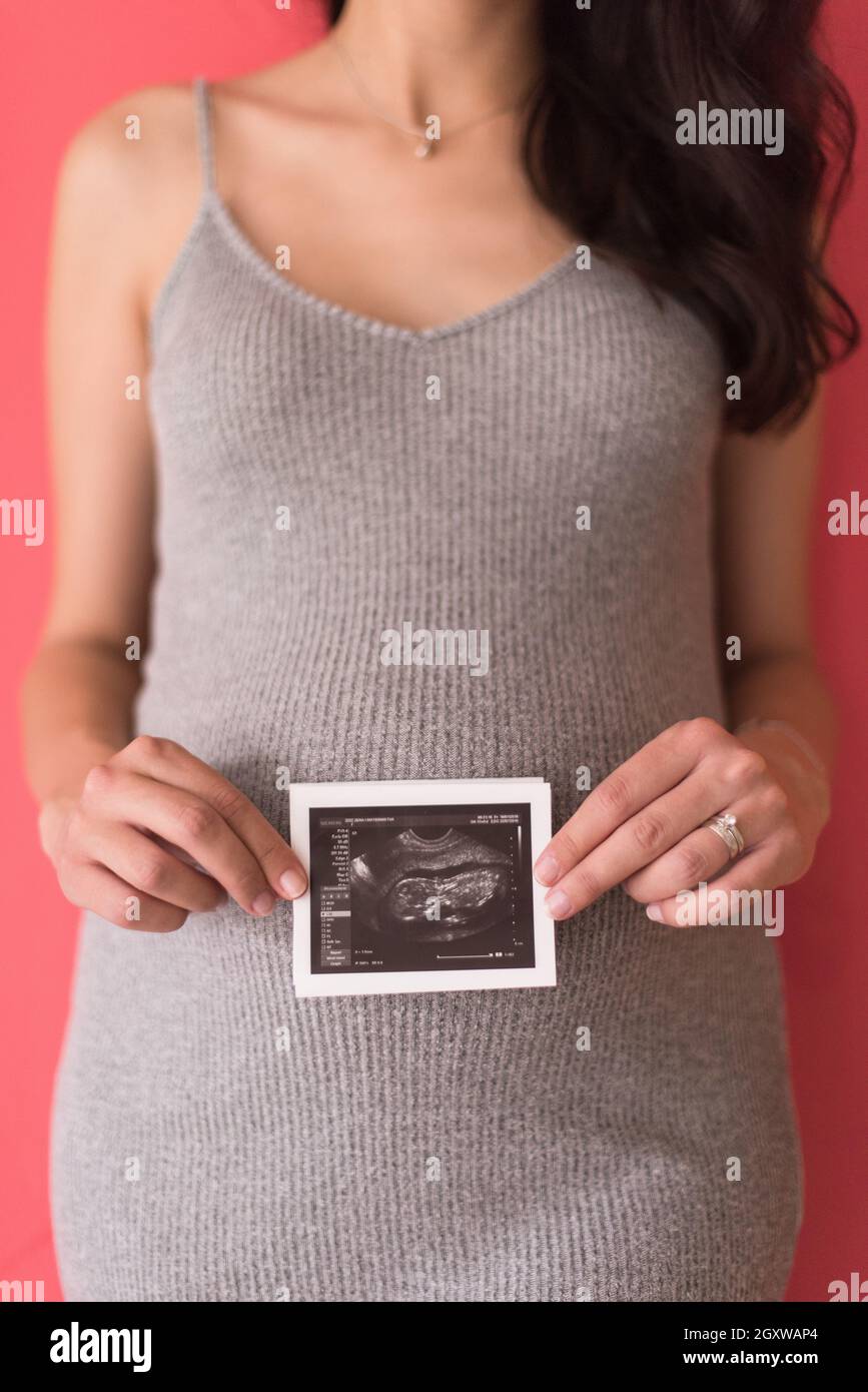 smiling pregnant woman showing ultrasound picture of her unborn baby ...