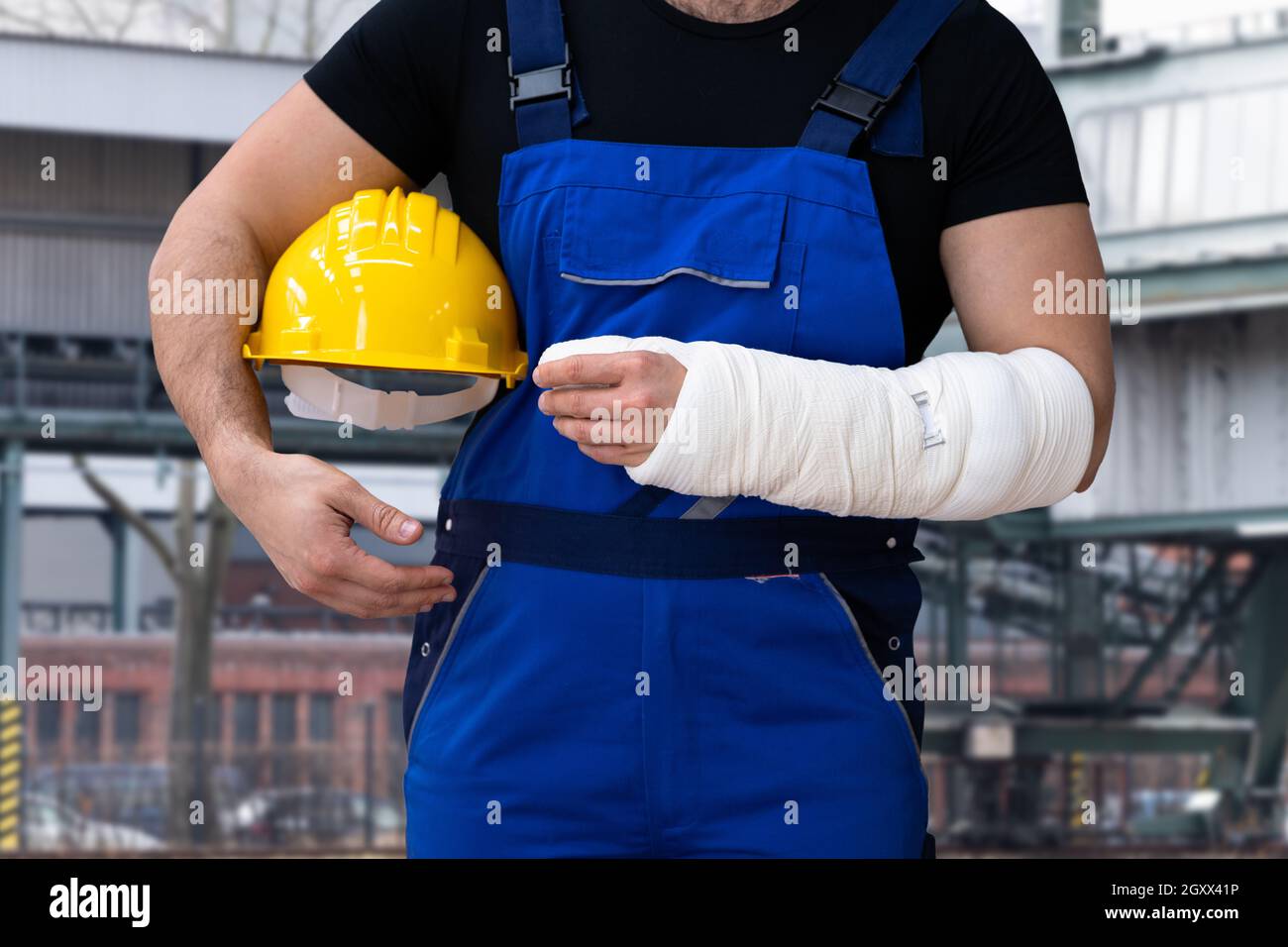 Adult Hurt At Job. Broken Arm Pain Stock Photo - Alamy
