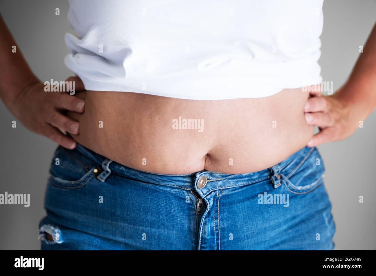 Fat Woman Belly Button And Body On Diet Stock Photo - Alamy