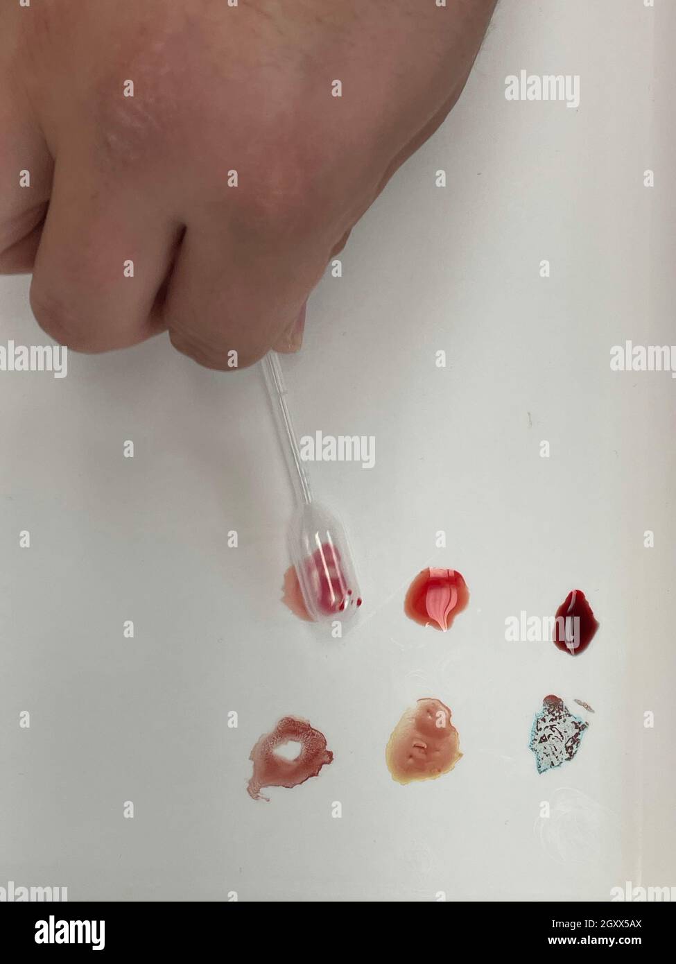 Medical doctor performing a quick blood group determination by using ...