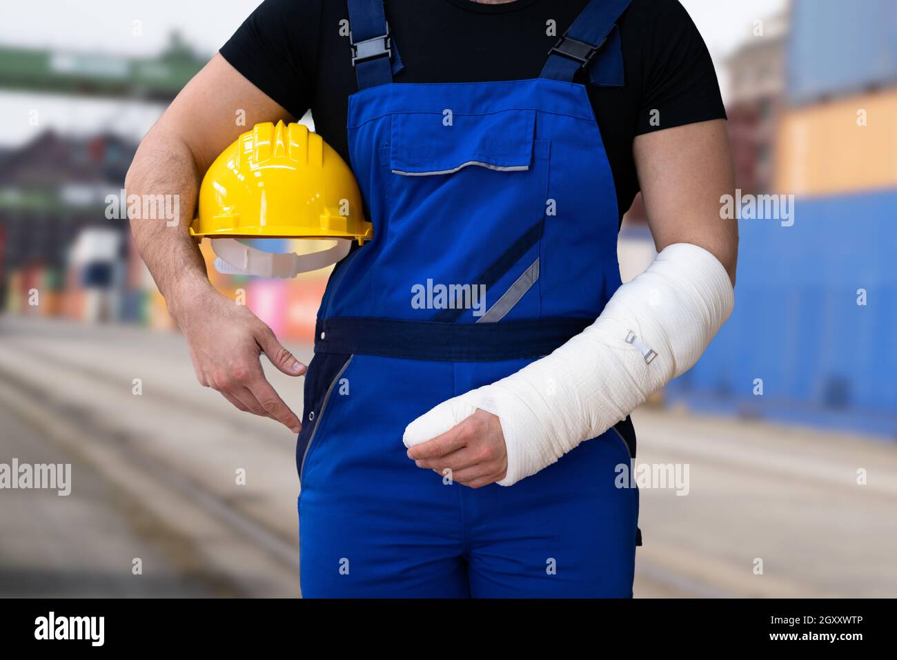 Adult Hurt At Job. Broken Arm Pain Stock Photo - Alamy