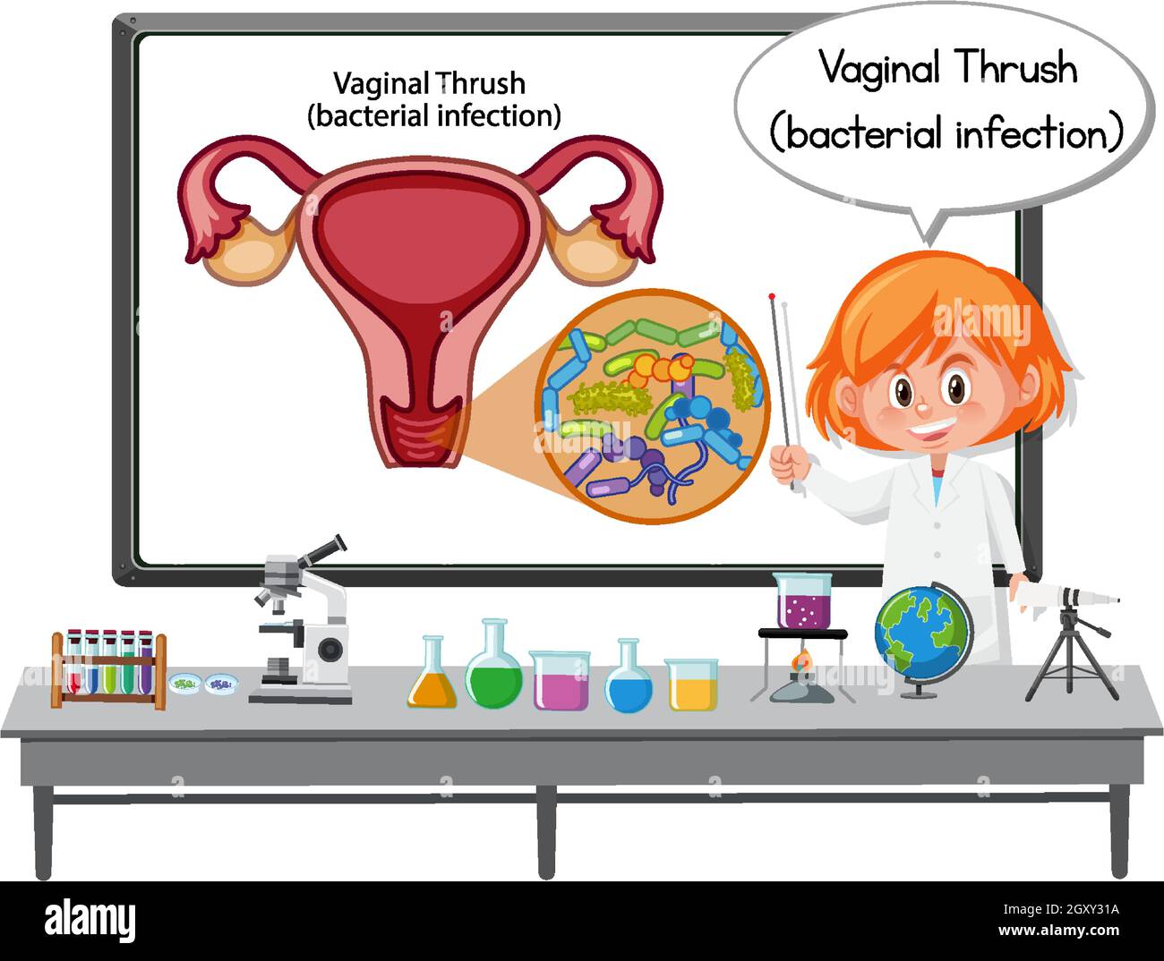 Young doctor explaining vaginal thrush (bacterial infection ...