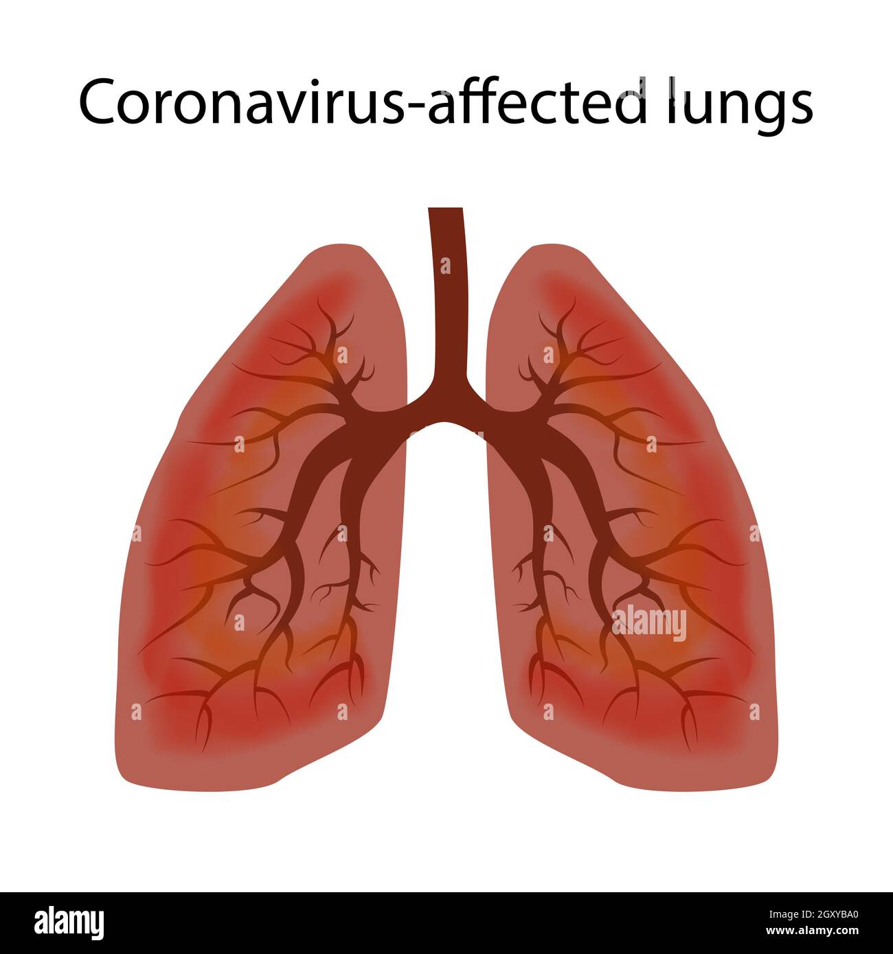 Damaged body Stock Vector Images - Alamy