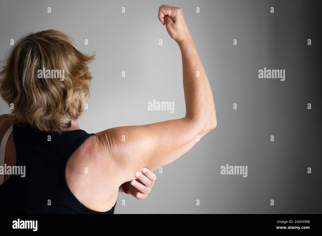 Older Woman Cosmetic Liposuction Surgery And Body Fat Check Stock Photo ...