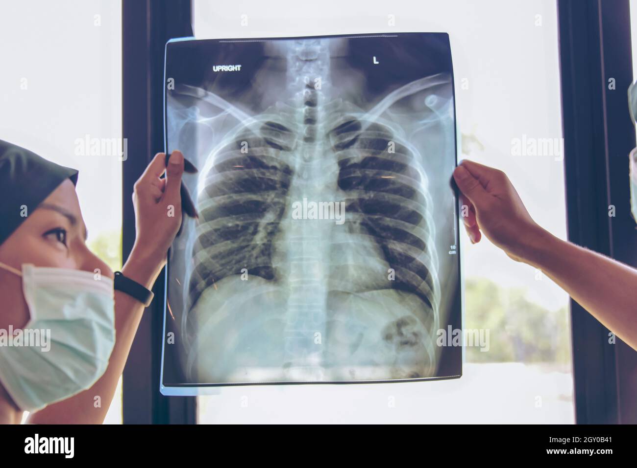 Doctor checking examining chest x-ray film of patient at ward hospital ...