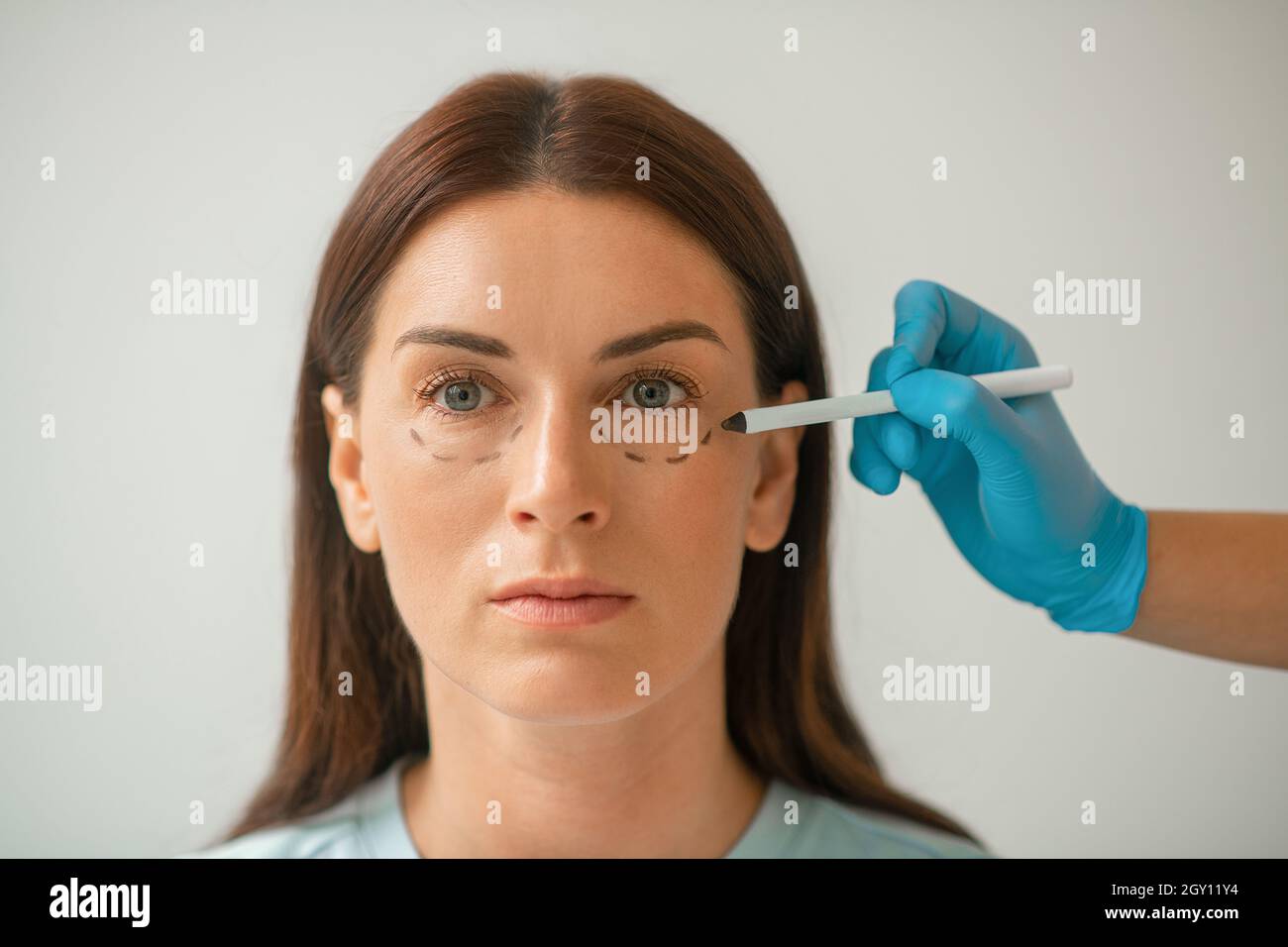 Cosmetologist drawing lines on womans face for lifting procedures Stock ...