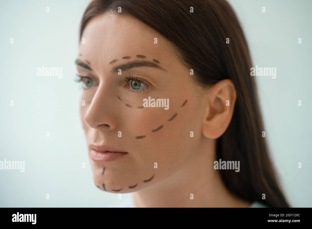Woman plastic surgery lines face hi-res stock photography and images ...
