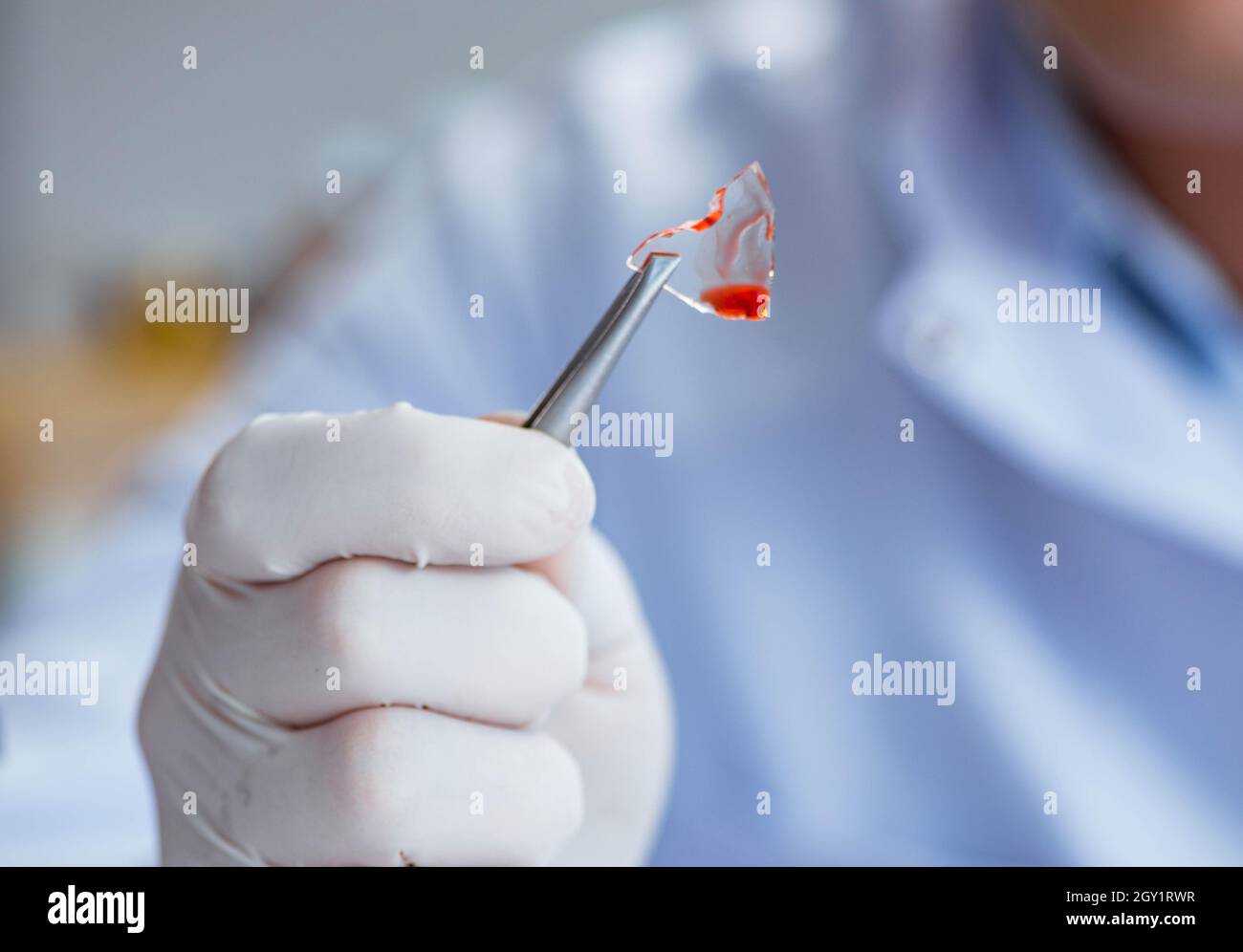 The young doctor working on blood test in lab hospital Stock Photo - Alamy