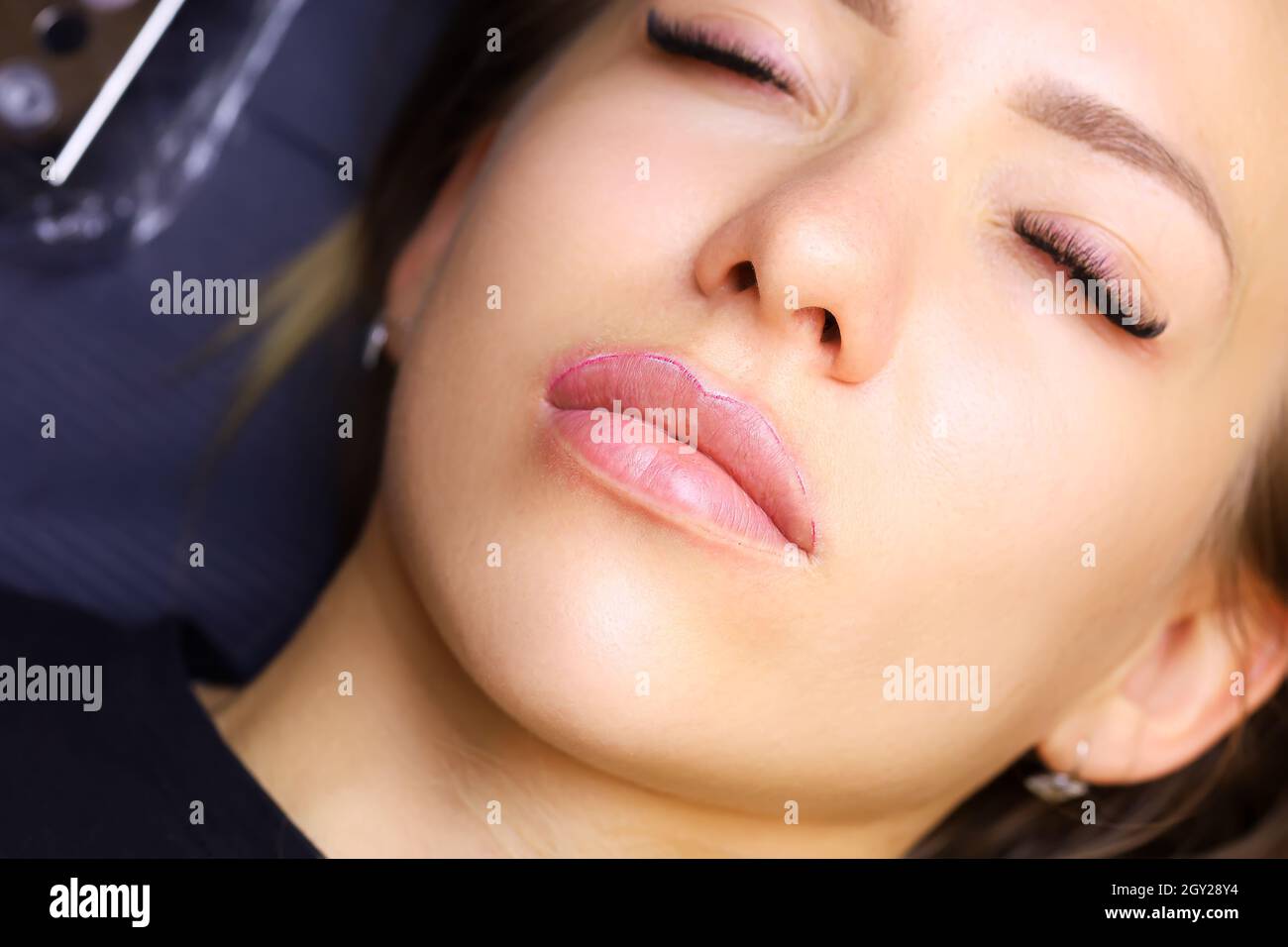 a young girl model is lying on the procedure of permanent lip makeup ...