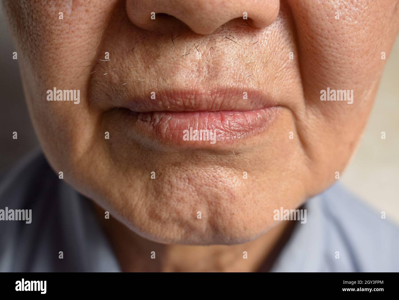 Nasolabial folds hi-res stock photography and images - Alamy