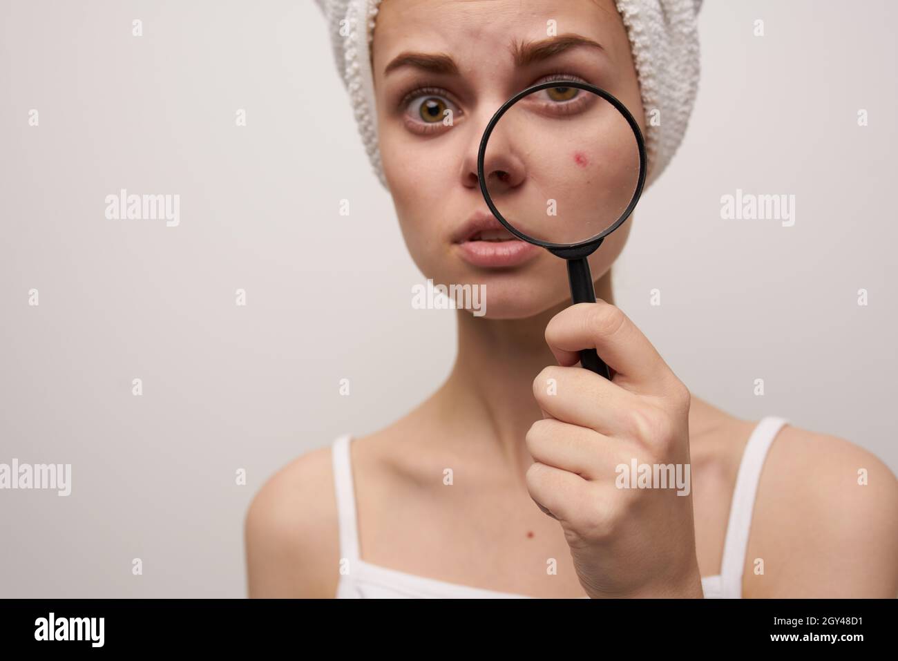 woman with a magnifying glass in hand skin problems close-up Stock ...