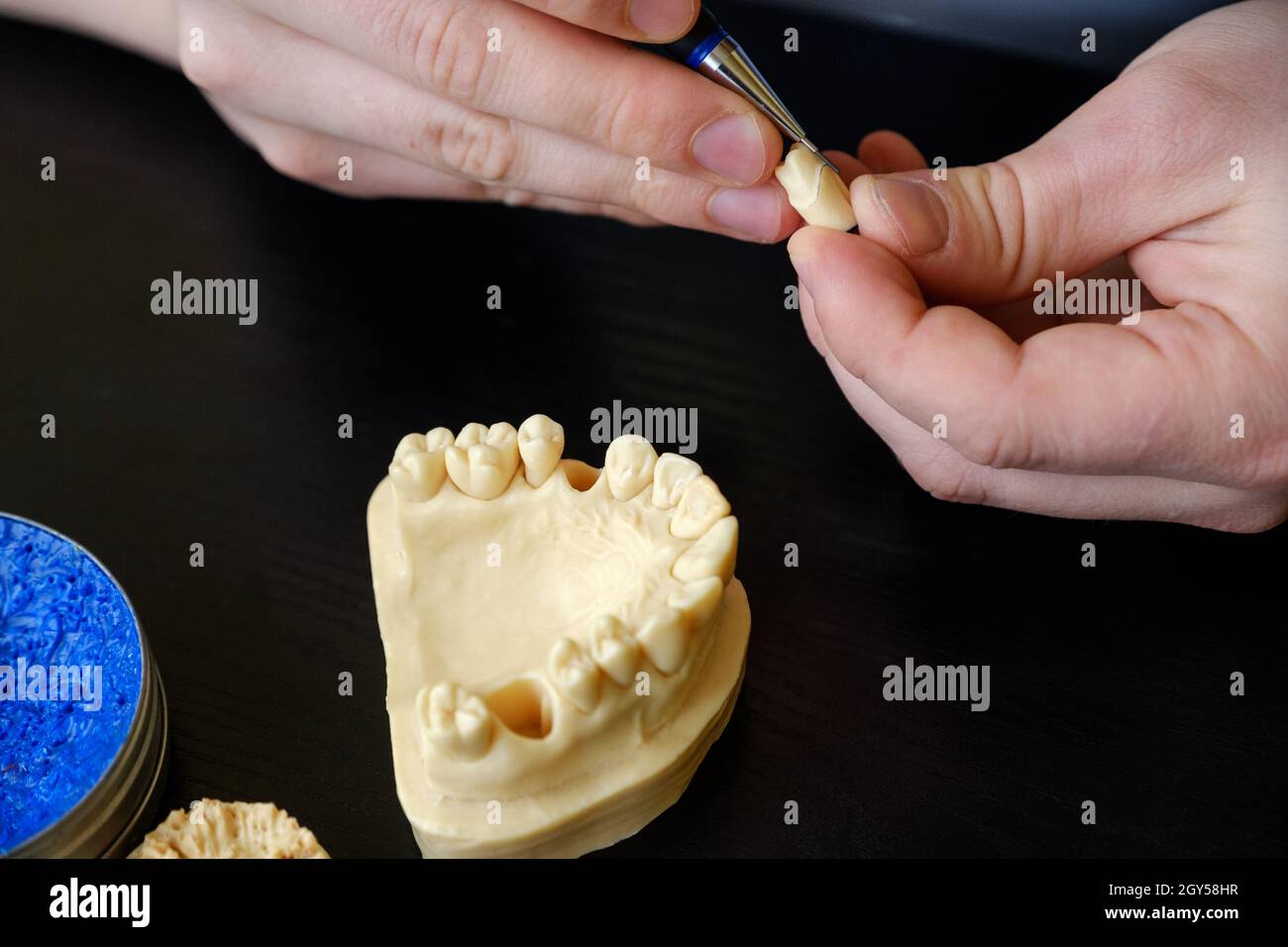 The dental technician is engaged in a modeling of artificial dentures ...