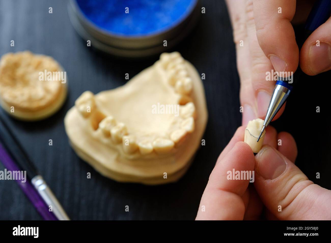 The dental technician is engaged in a modeling of artificial dentures ...