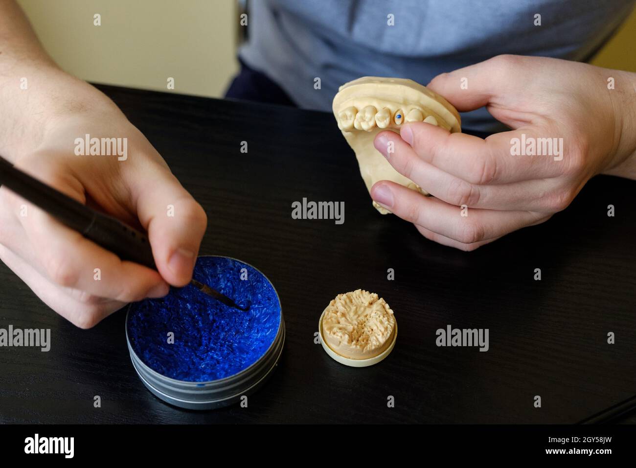Dental technician modelling tooth crowns with hot wax. Workplace of a ...