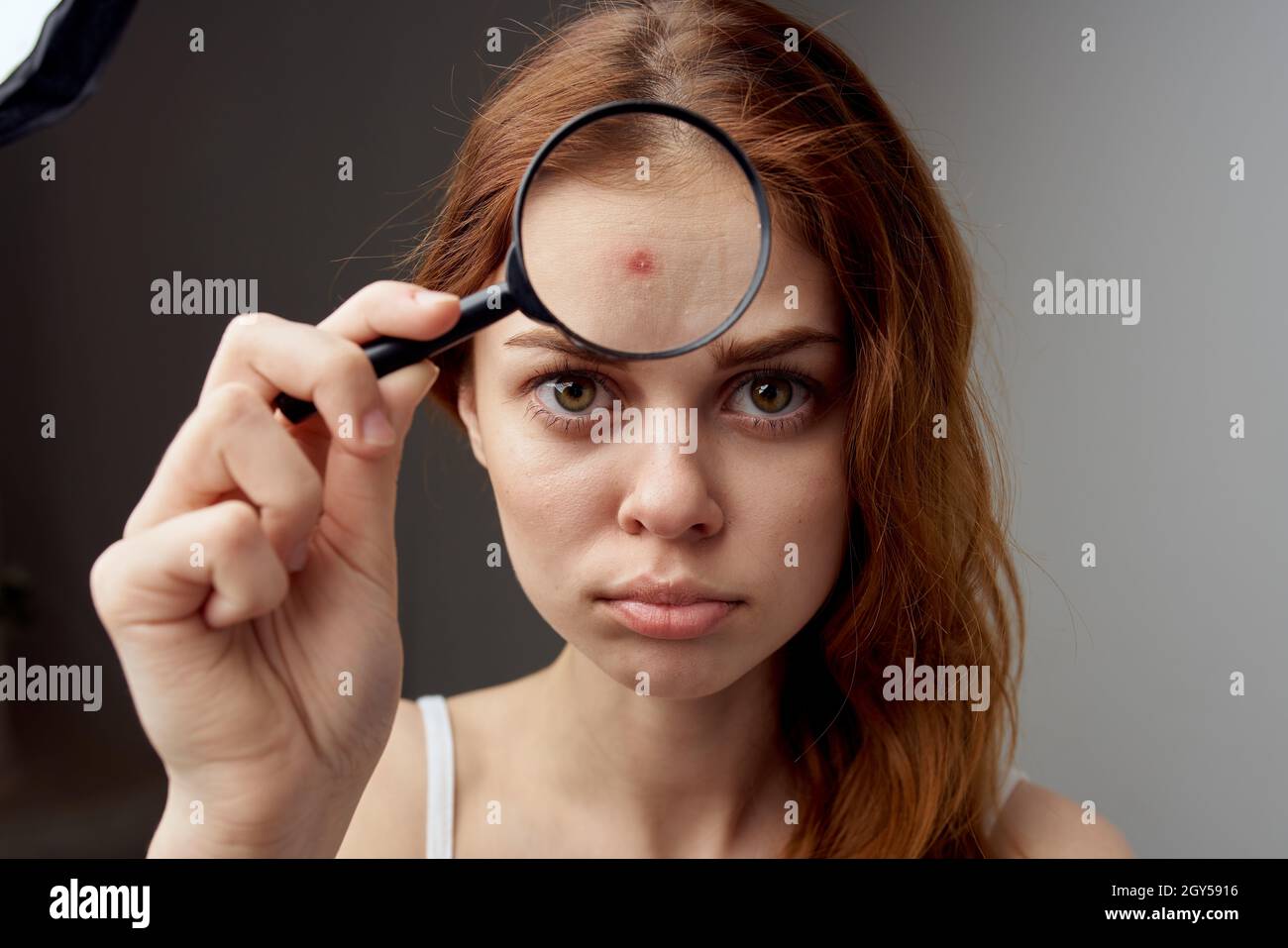 pretty woman skin problems cosmetology Studio Stock Photo - Alamy