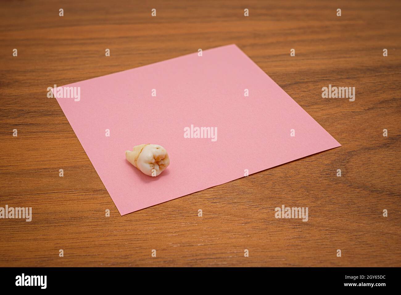 Wisdom tooth on pink paper with free space for text Stock Photo - Alamy