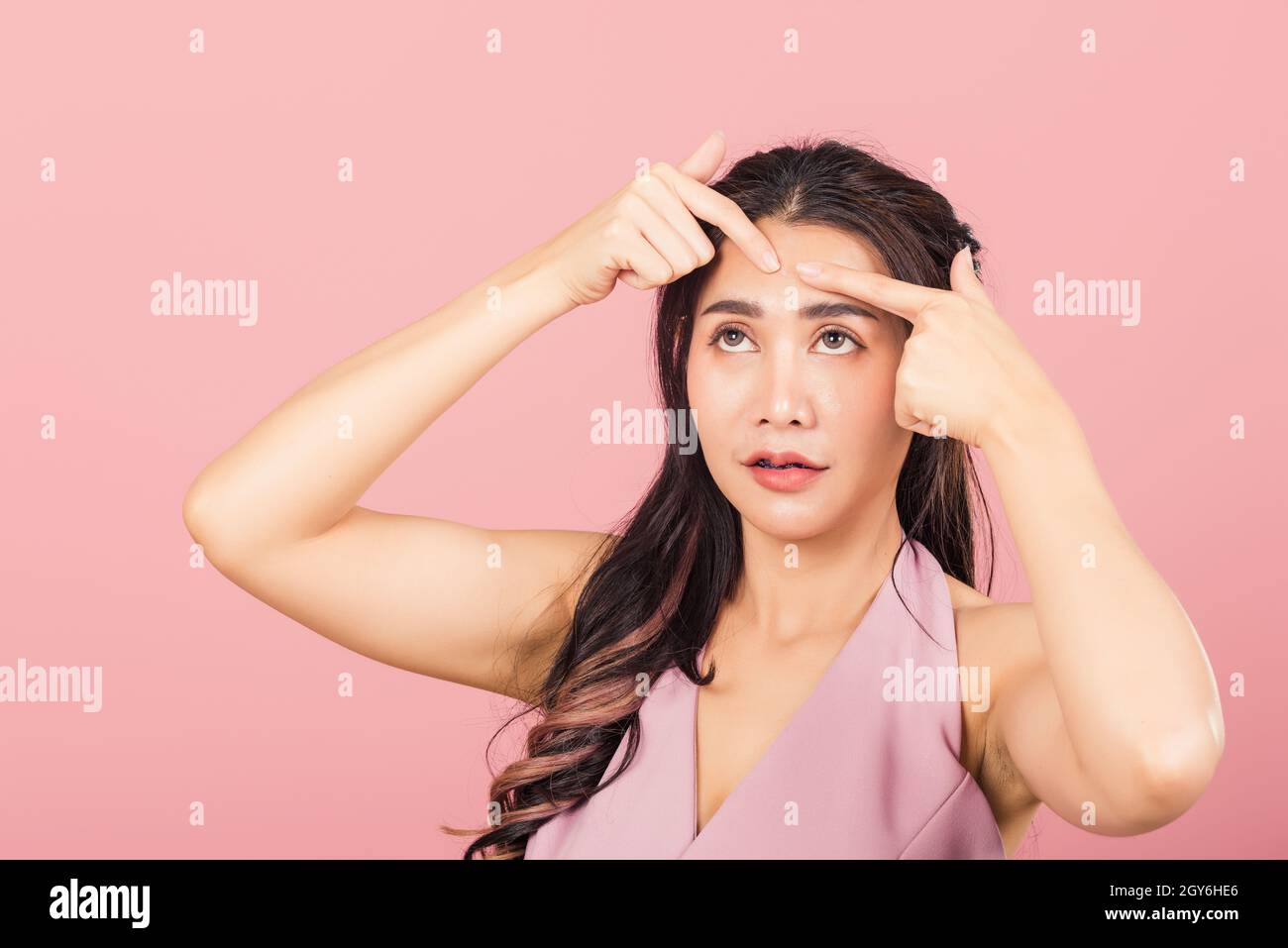 Pink pimple skin hi-res stock photography and images - Alamy