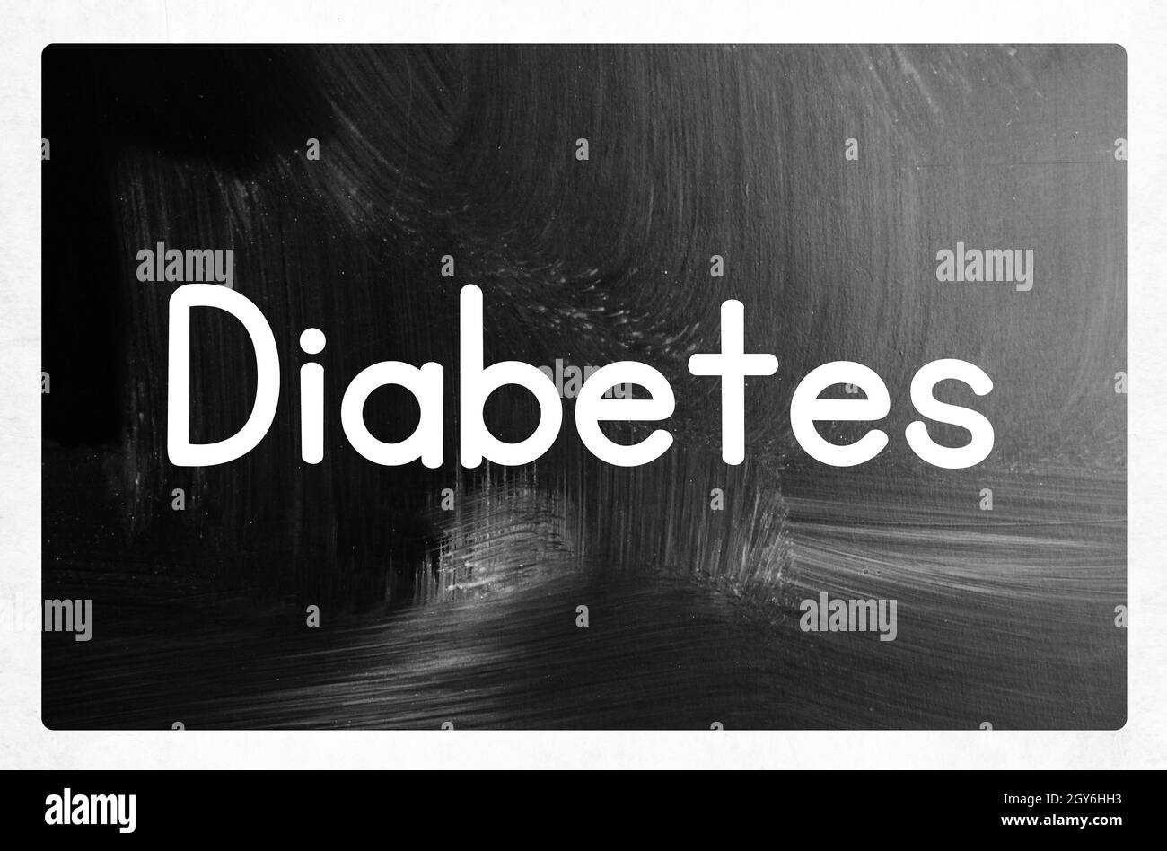 Type 2 diabetes mellitus Black and White Stock Photos & Images - Alamy