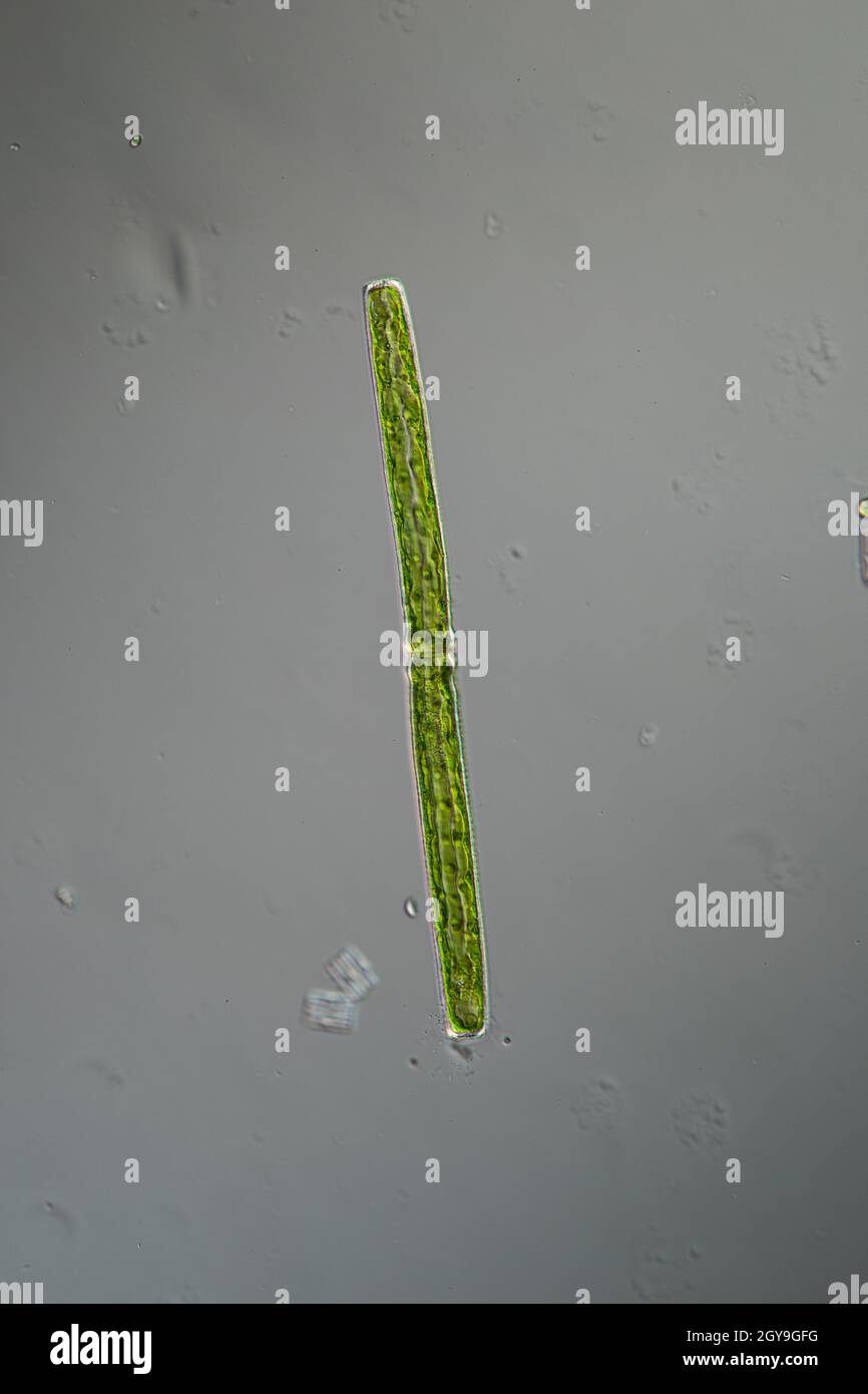 Green algae under the microscope 100x Stock Photo - Alamy