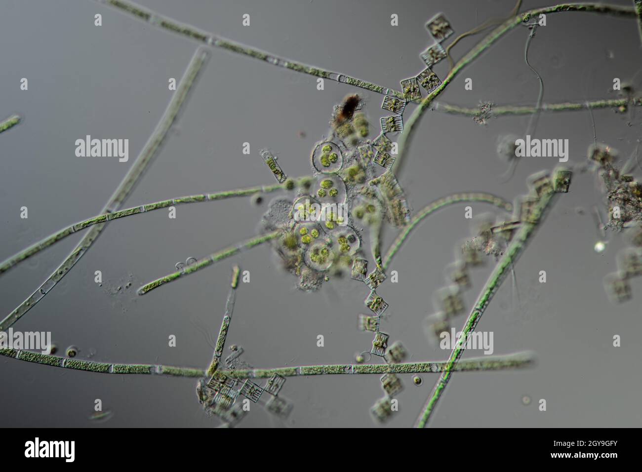 Green algae under the microscope 100x Stock Photo - Alamy