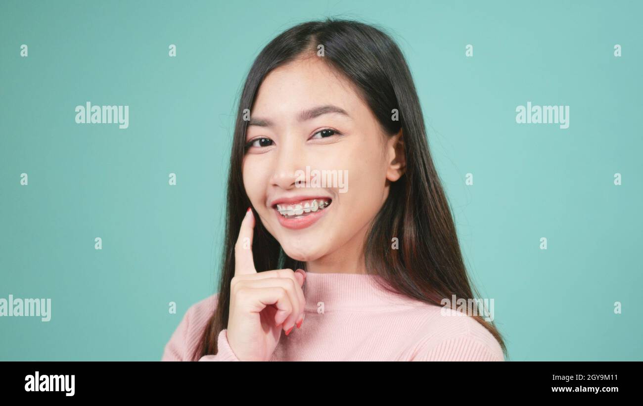 Portrait young Asian beautiful woman smiling wear silicone orthodontic ...