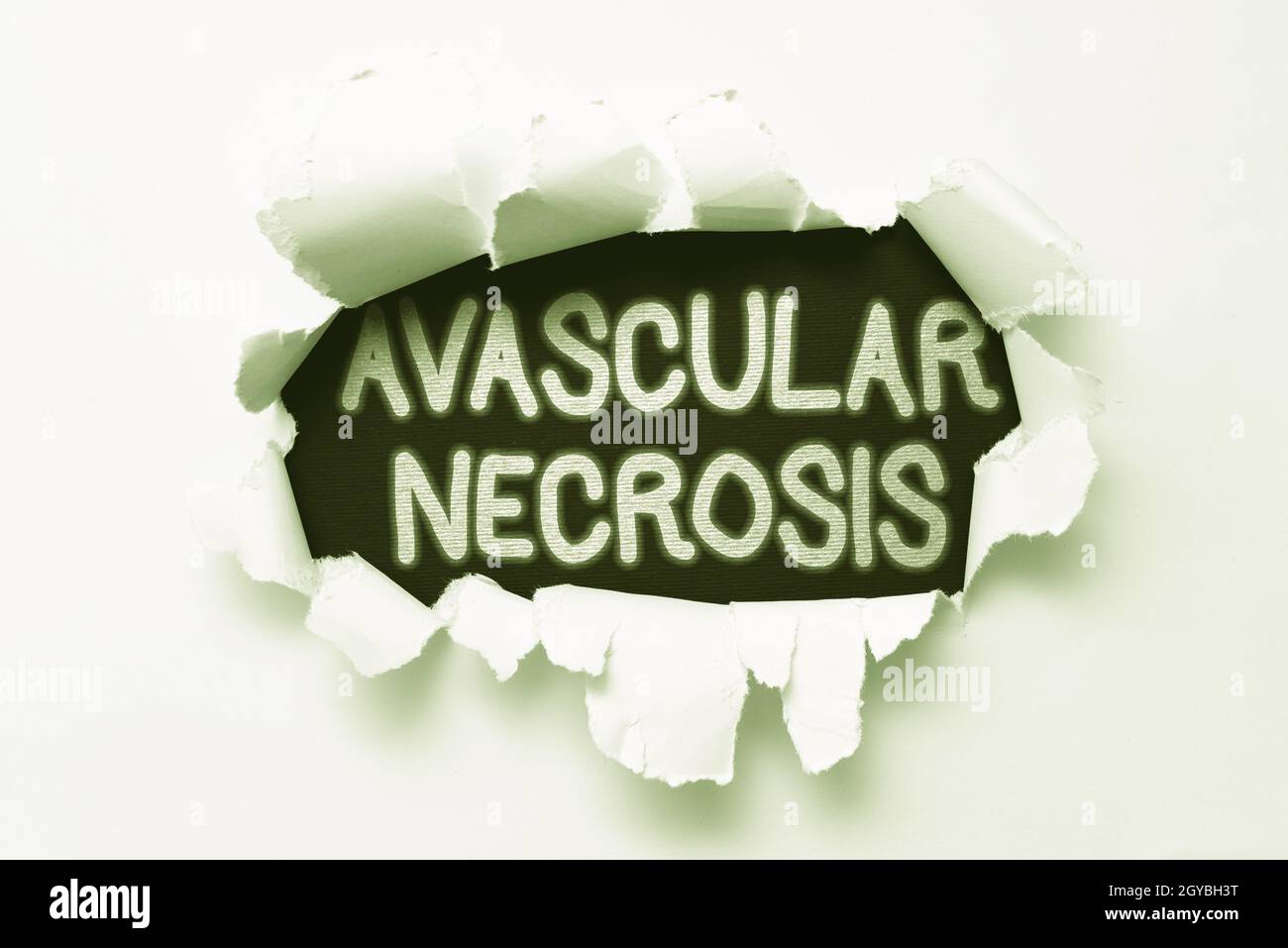 Text sign showing Avascular Necrosis, Concept meaning death of bone ...