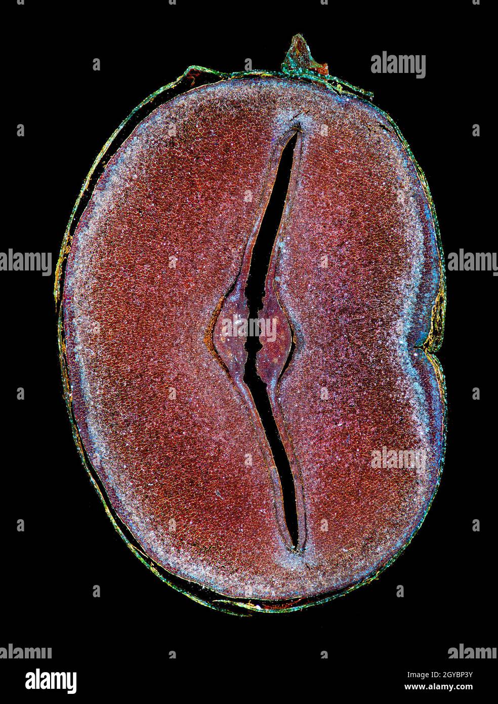 Castor oil seed, LS section, stained. Darkfield photomicrograph Stock ...