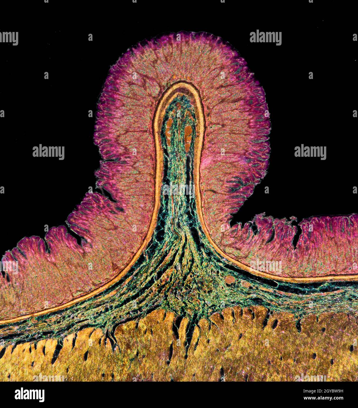 Corpus ventriculi slide section Stock Photo - Alamy