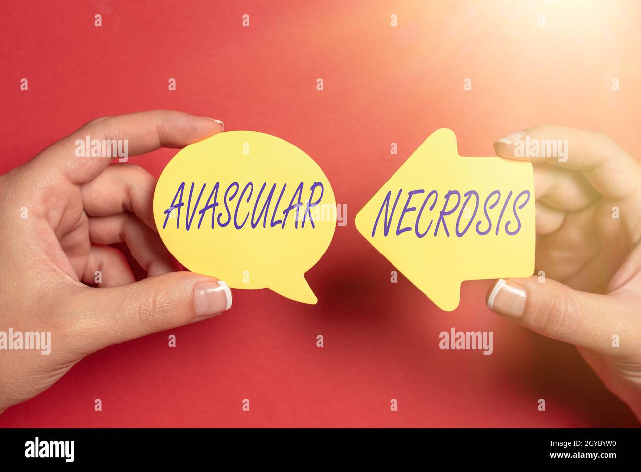 Text caption presenting Avascular Necrosis, Business concept death of ...