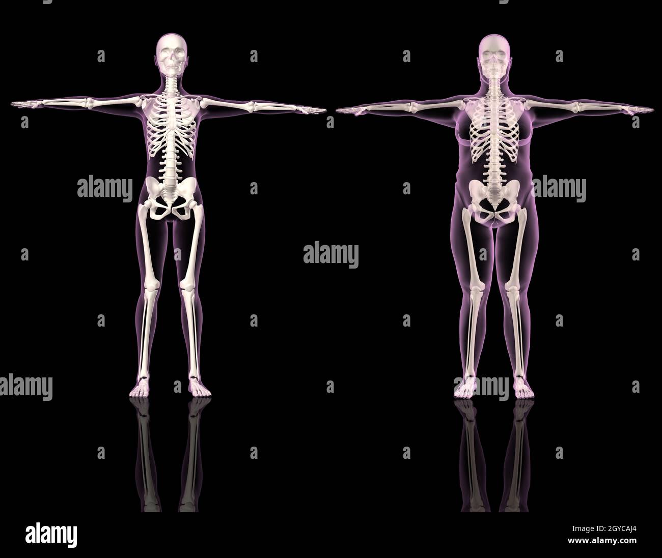 3D renders of two female skeletons one slim and one overweight Stock ...