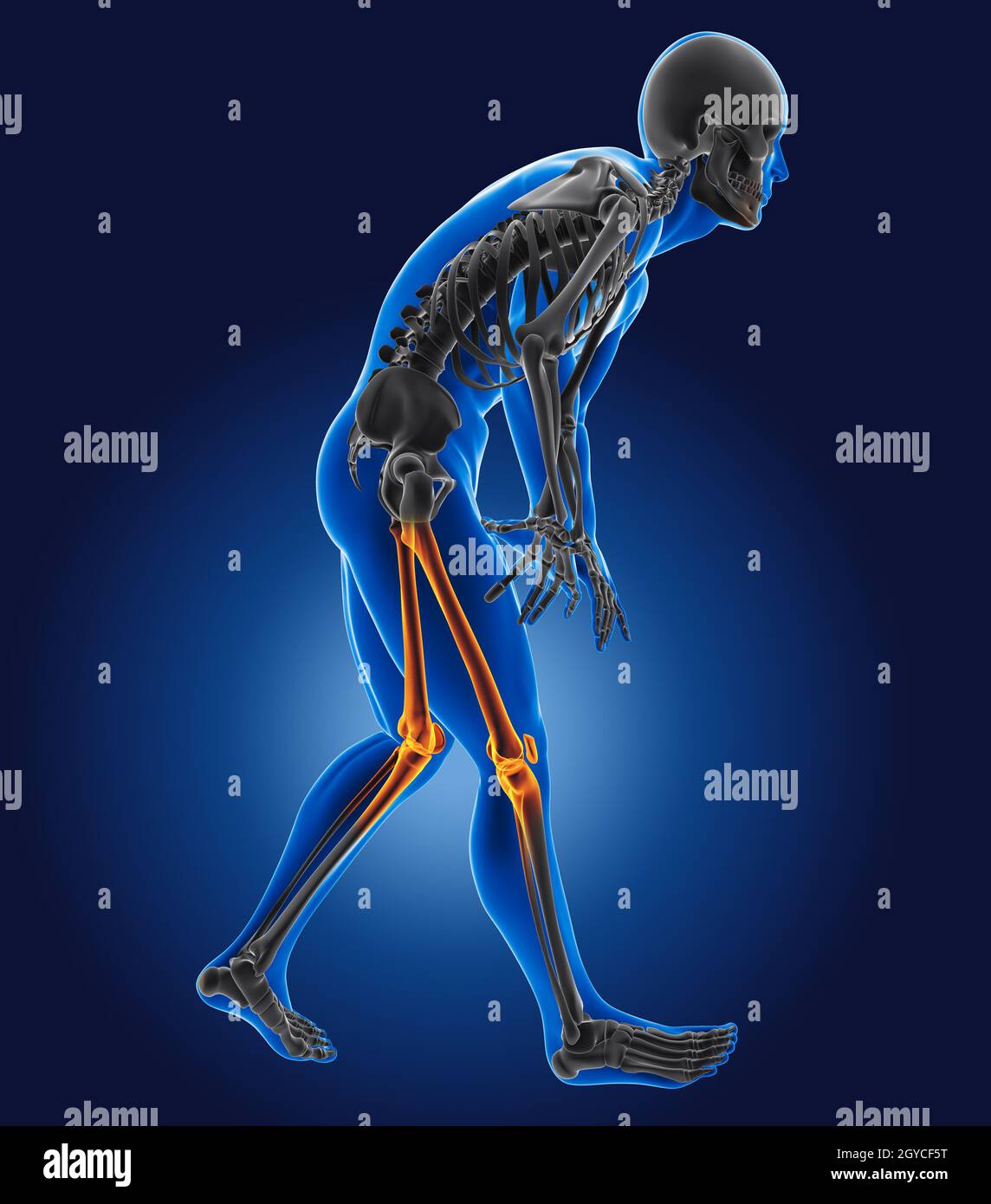 3D medical man with thigh bone highlighted Stock Photo - Alamy