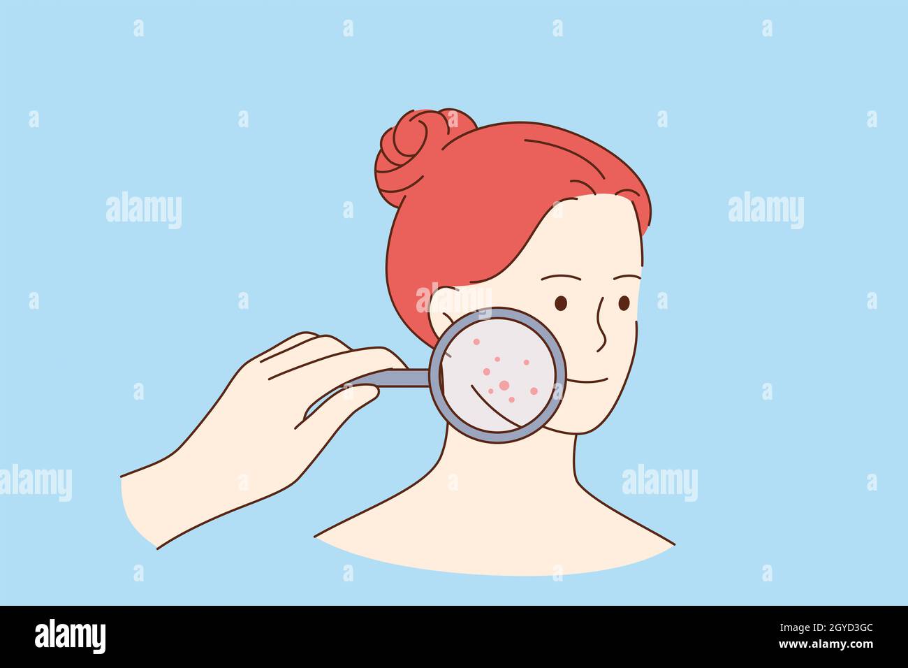 Skin problems and beauty concept. Face of young smiling pretty red ...