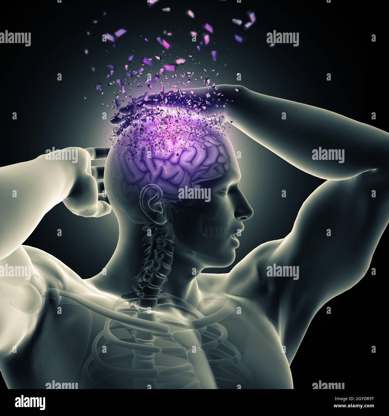3D render of a male figure holding head with brain shattering depicting ...