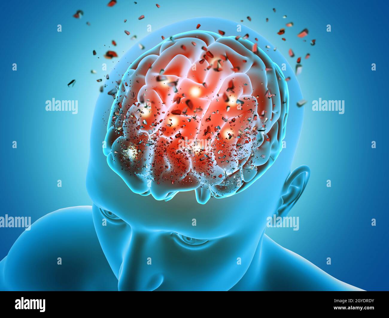 3D render of a male figure with brain parts shattering depicting mental ...