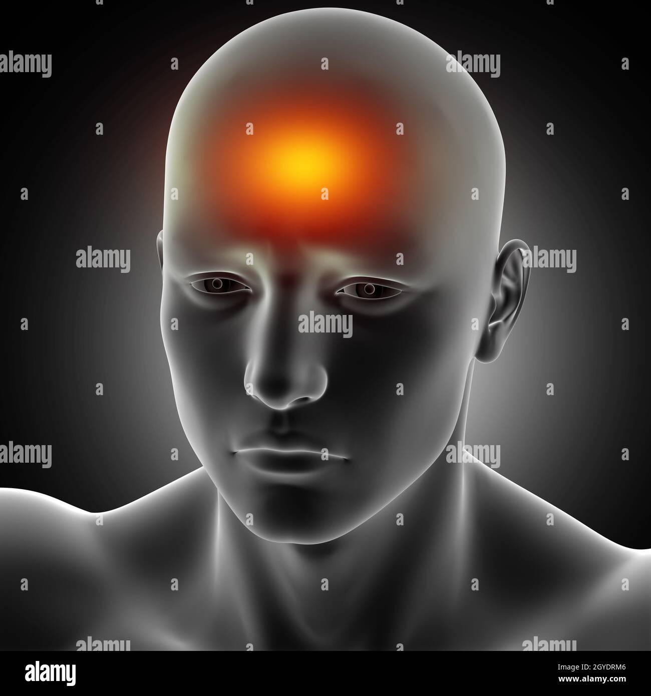 3D render of a male medical figure with headache Stock Photo - Alamy