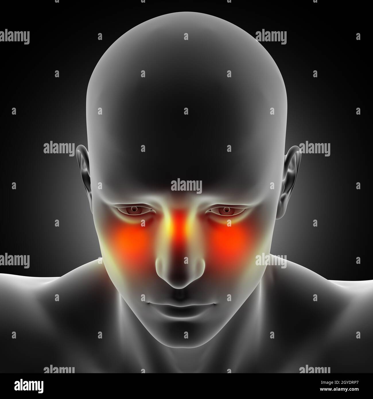 3D render of a male medical figure with sinus pain highlighted Stock ...