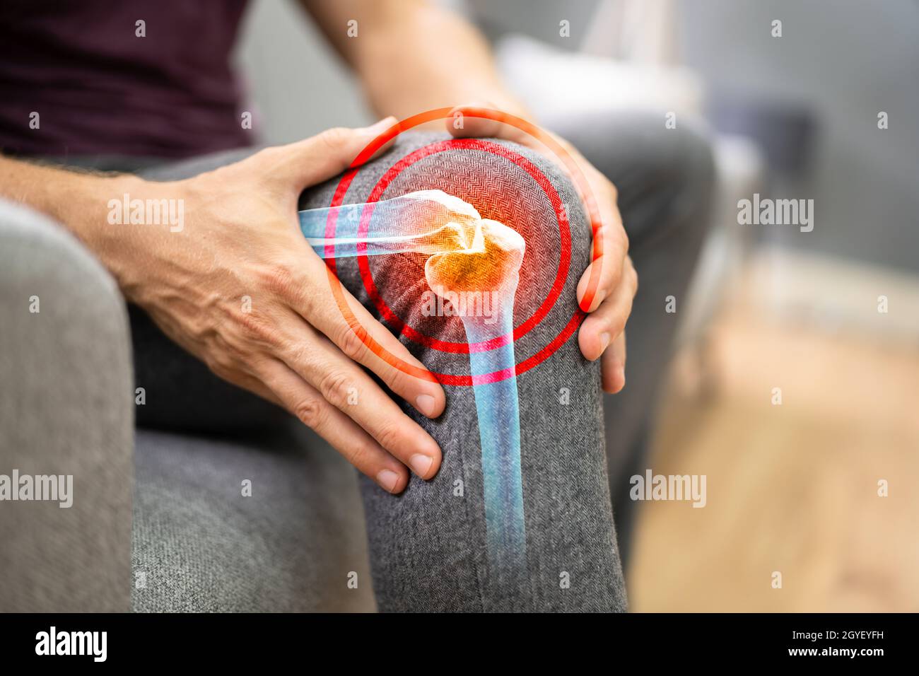 Man With Knee Pain. Joint Therapy Physical Stock Photo - Alamy