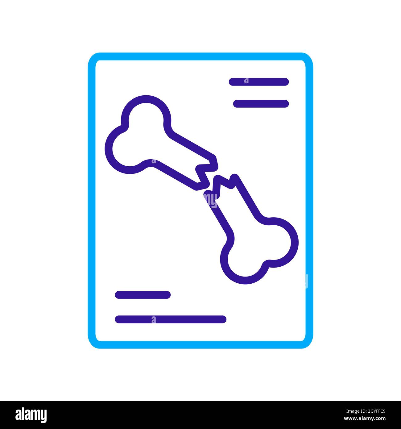Bone fracture X-ray scan vector icon. Medicine and healthcare, medical ...