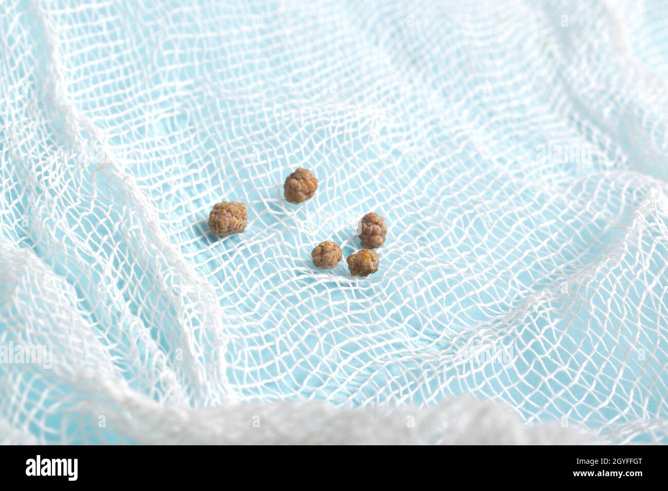 Gallstones hi-res stock photography and images - Alamy