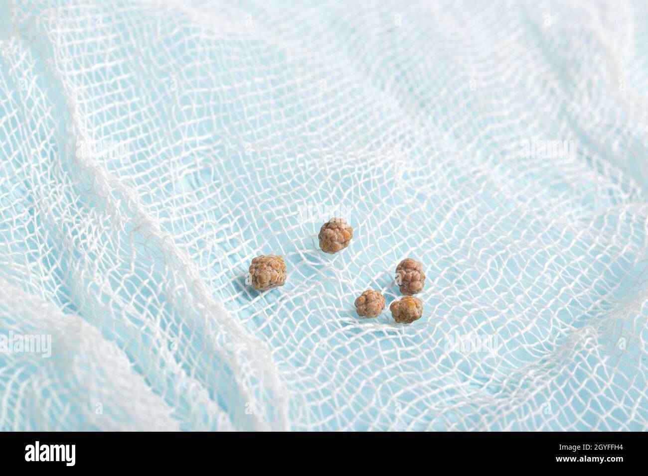 Gallbladder ultrasound hi-res stock photography and images - Alamy