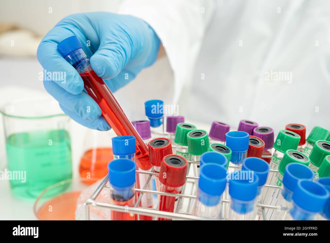 Scientist holding and analysis tube of micro biological sample with a ...