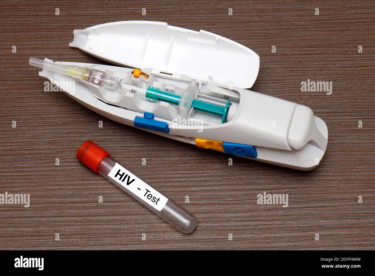 Test tube for blood collection with HIV test label in laboratory next ...