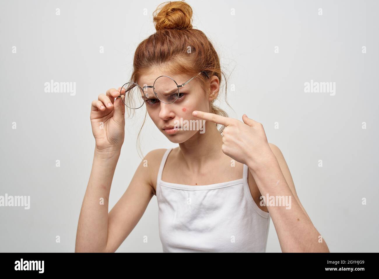 red-haired woman wearing glasses pimple on face dermatology skin care ...