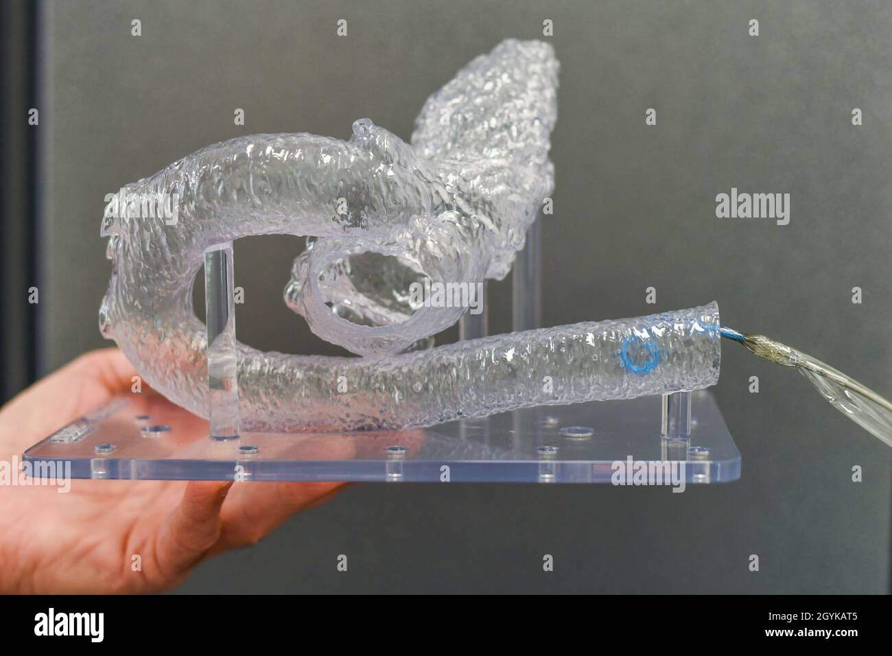 Percutaneous hi-res stock photography and images - Alamy