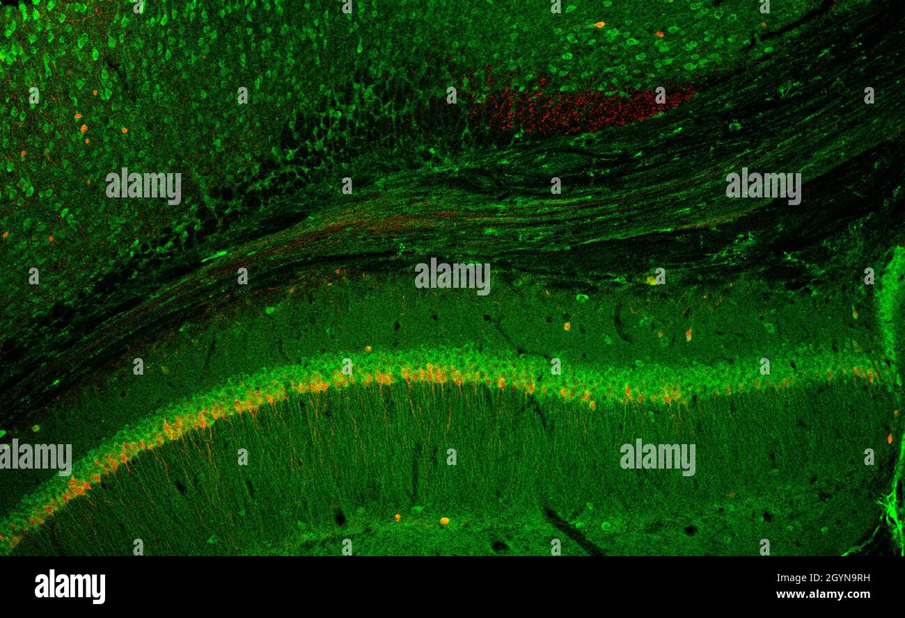 Confocal laser scanning microscopy image of immunofluorescence ...